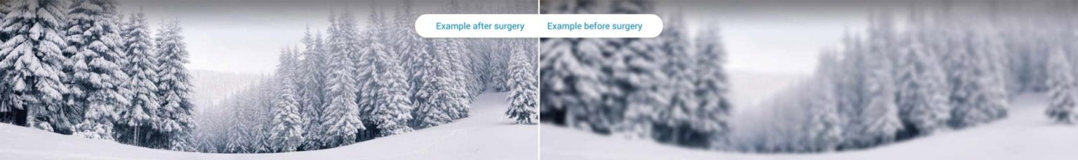 Astigmatism Laser Eye Surgery | Focus Clinics