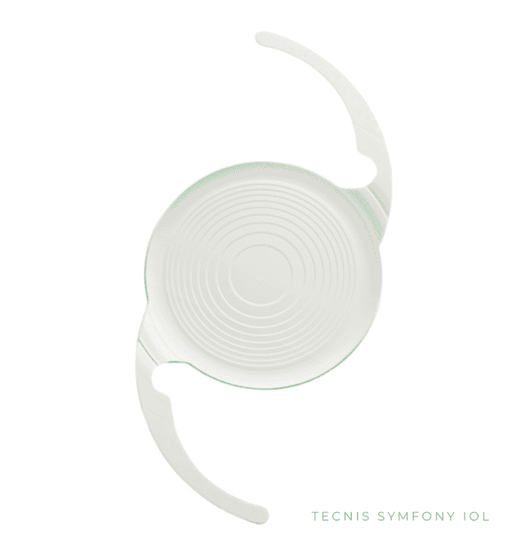 Cataract Surgery Patients Guide | Focus Clinics