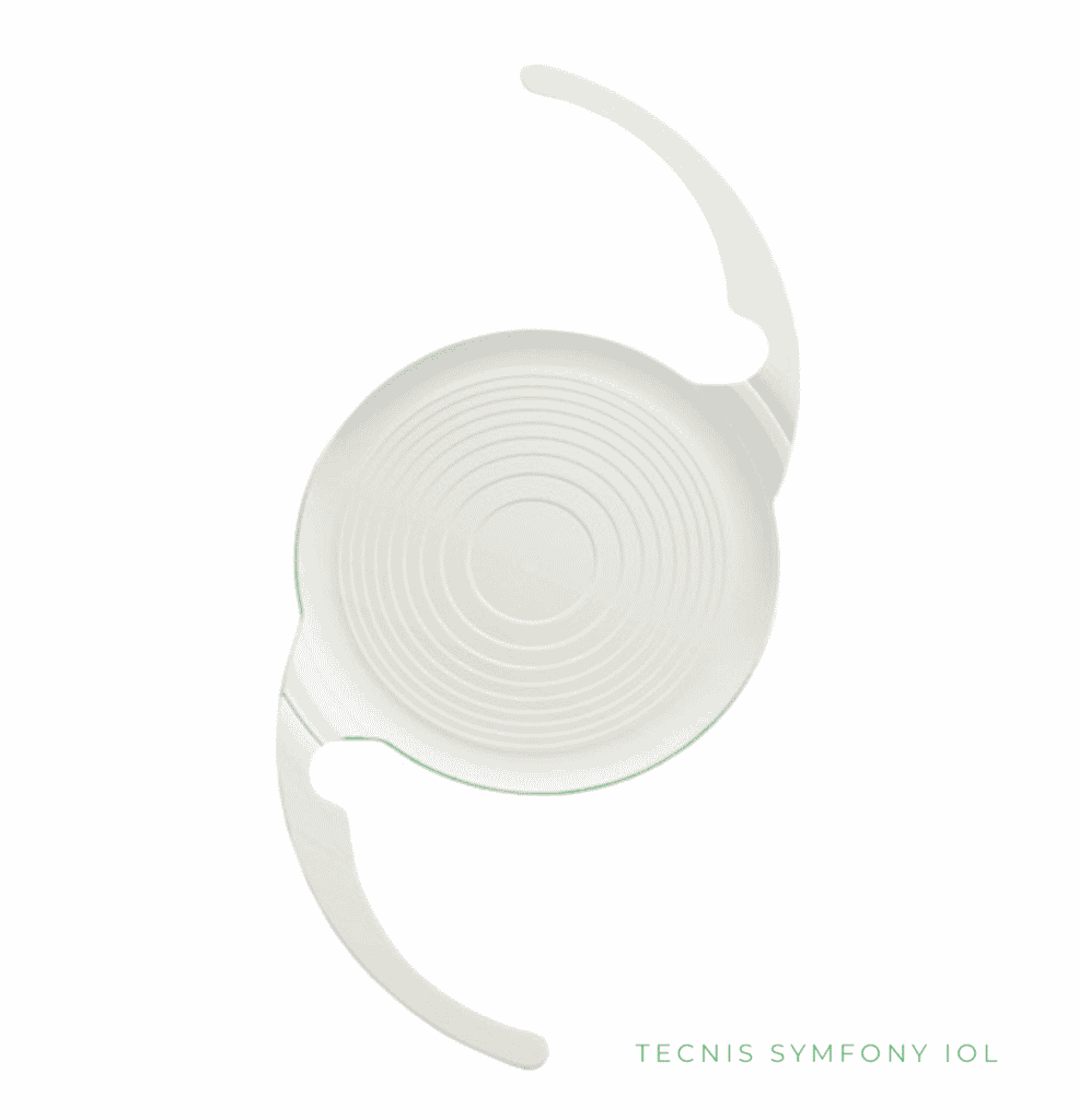 Cataract Surgery Patients Guide | Focus Clinics