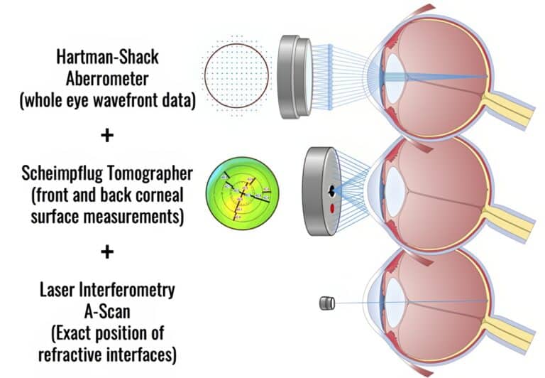 Ray-Tracing Guided LASIK | Book Your Consultation